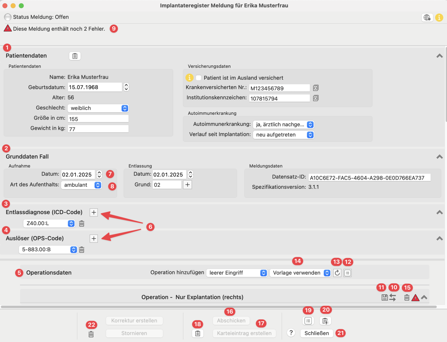 Implantateregister Deutschland (IRD) | tomedo® Onlinehilfe